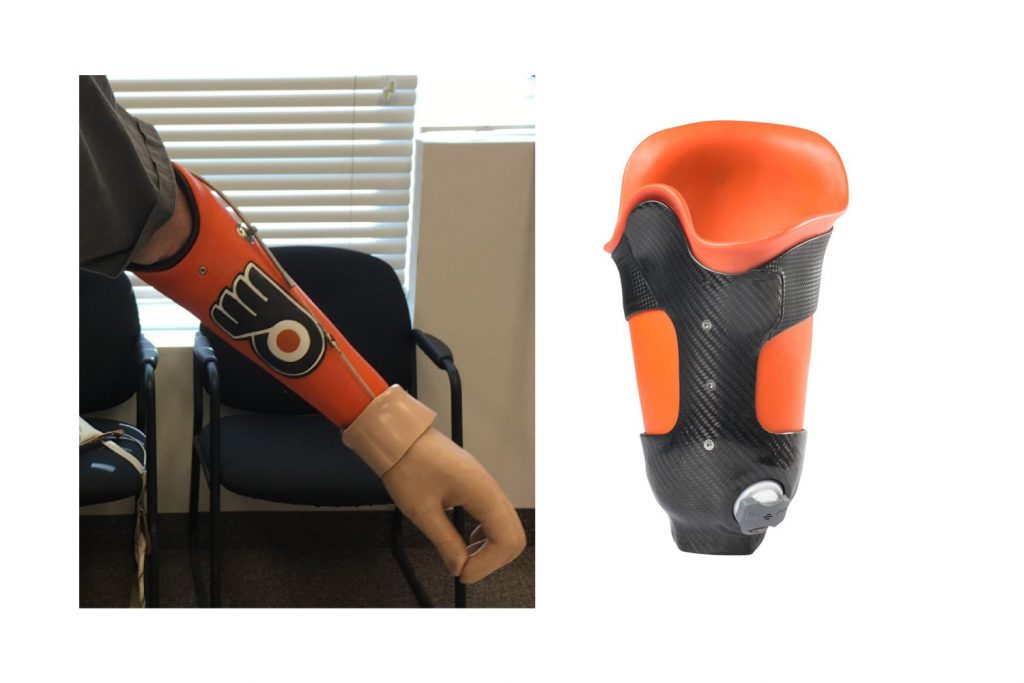 SiOCX Sockets – Cascade Prosthetic Services Ltd.